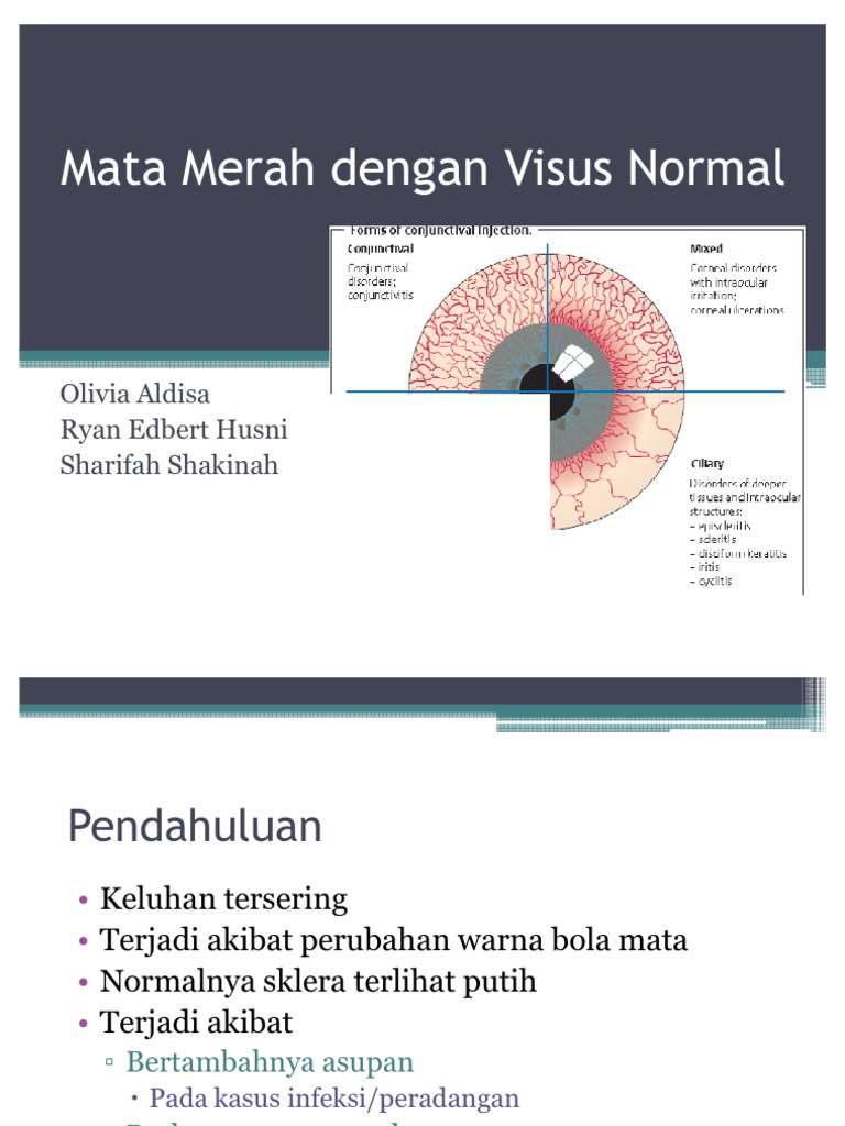 Mata Merah Dengan Visus Normal | PDF | Kesehatan Holistik | Sains ...
