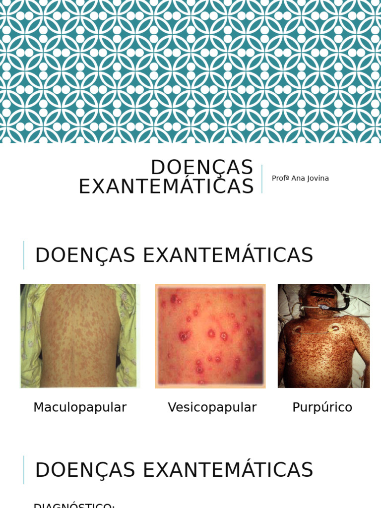 DoenÃ As Exantemã¡ticas | PDF | Medicina Clínica | Especialidades médicas