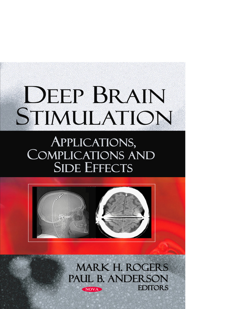 Vdoc.pub Deep Brain Stimulation Applications Complications and Side ...