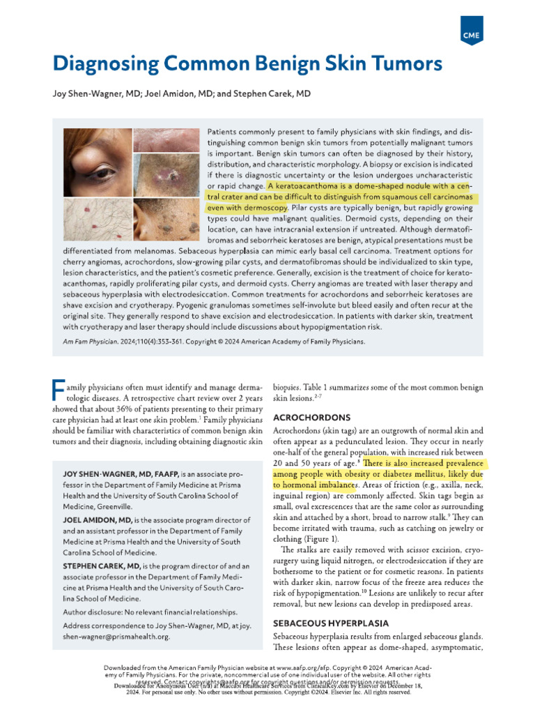 Diagnosing Common Benign Skin Tumors | PDF