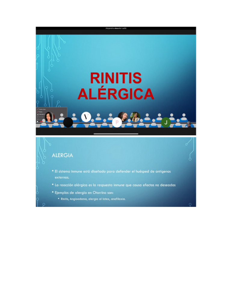 Rinitis alérgica | PDF