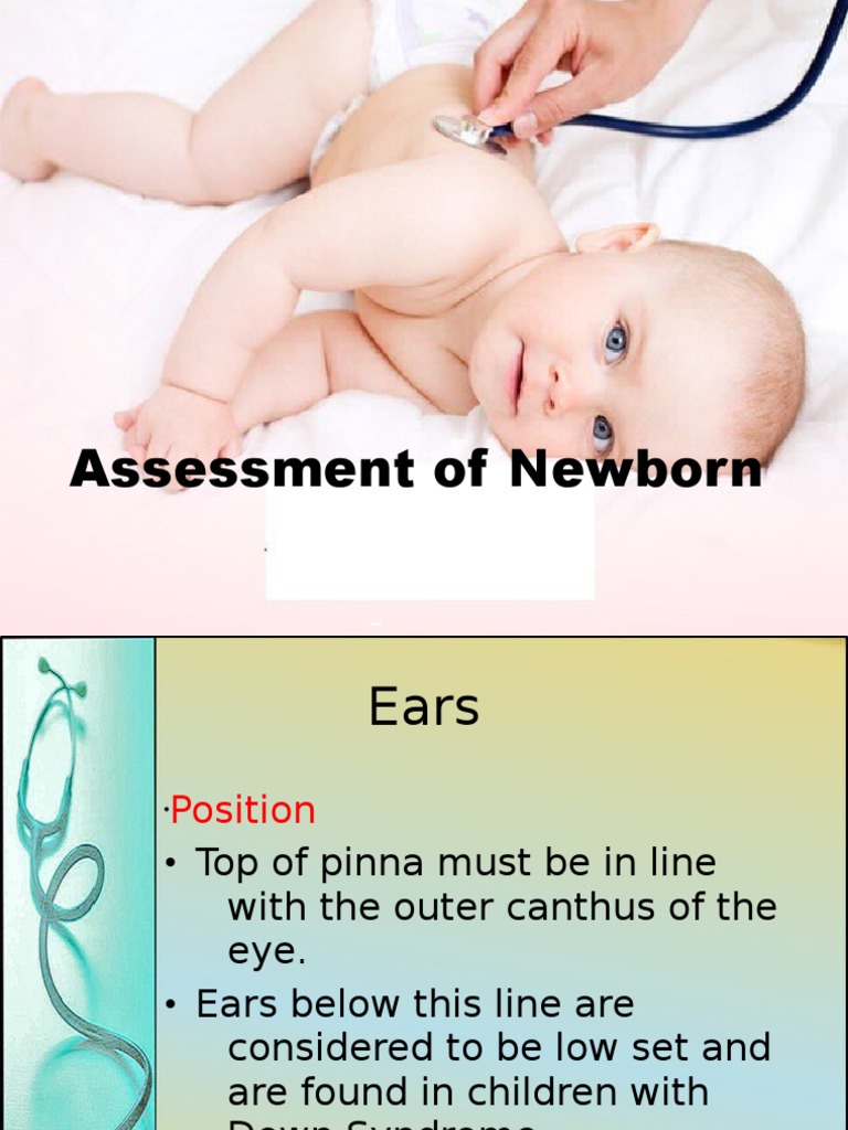 Assessment of Newborn | PDF | Infants | Stomach