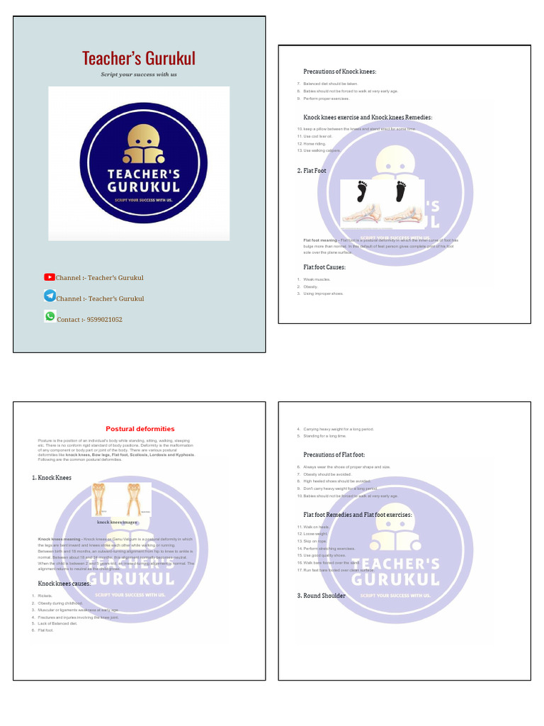 Postural Deformities Class Notes | PDF | Foot | Scoliosis