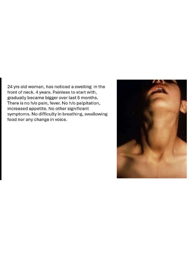 Thyroid Goitre Case | PDF