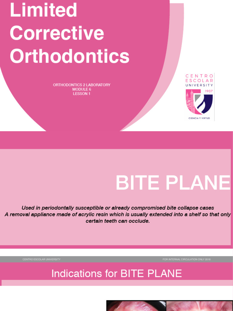 Limited Corrective Ortho (Module 6 Lesson 1) | PDF | Tooth | Mouth
