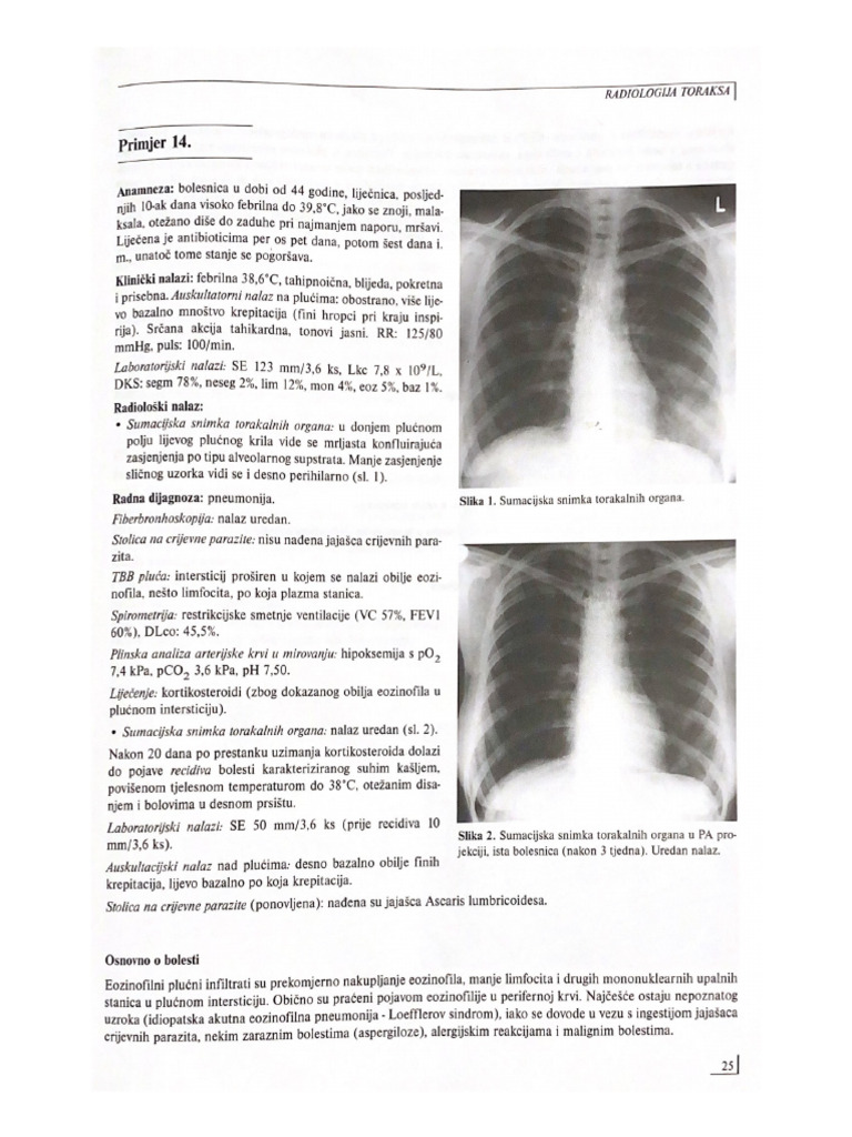 Radiologija Toraksa | PDF