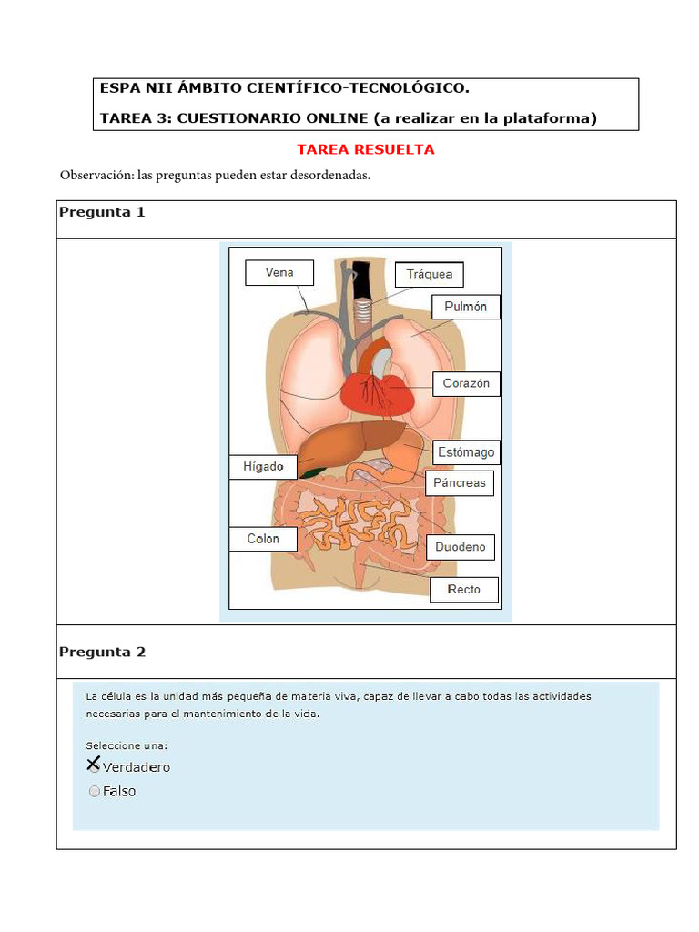 MIV Tarea 3 Cuestionario RESUELTA | PDF