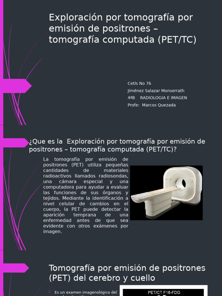 Exploración Por Tomografía Por Emisión de Positrones | PDF | Ct Scan | Tomografía de emisión de ...
