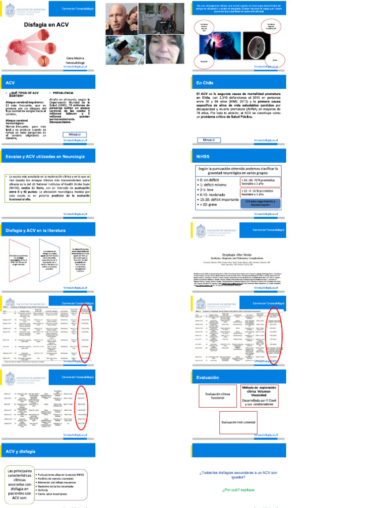 Disfagia en ACV | PDF | Carrera | Neurología