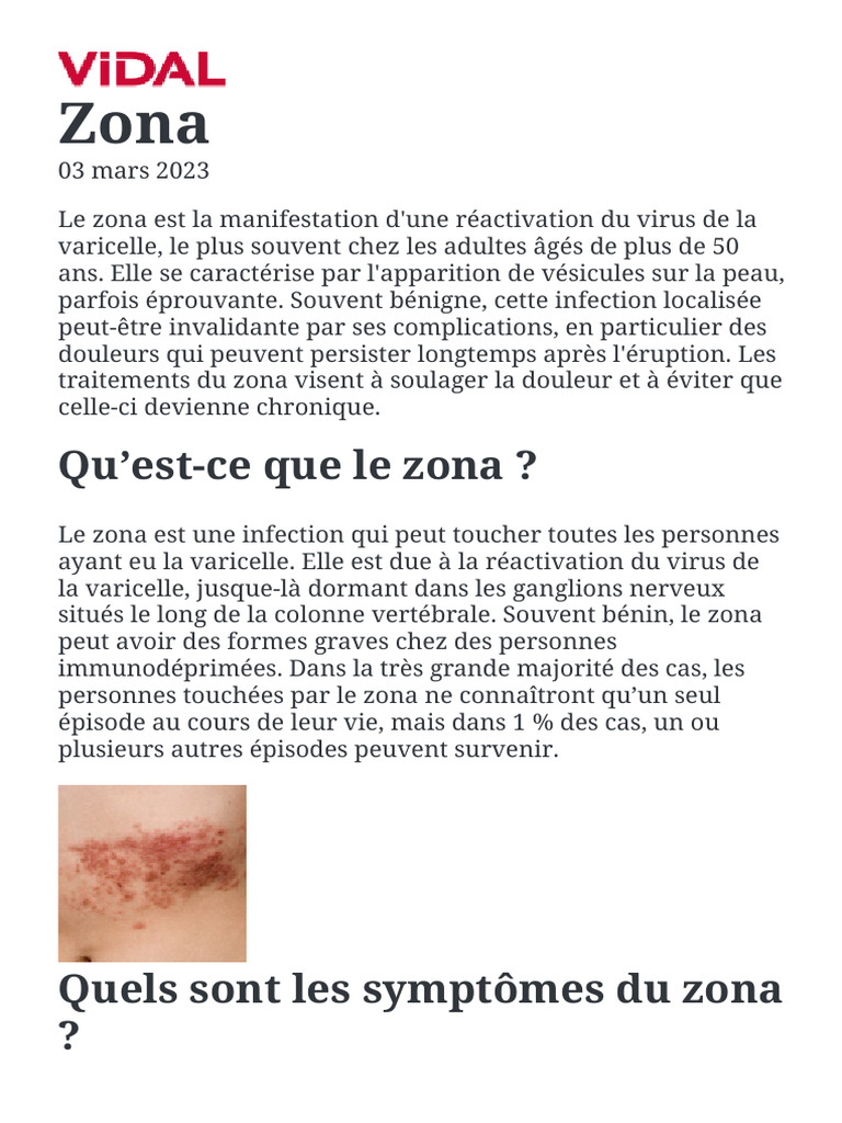 Zona - Symptômes, Causes, Traitements Et Prévention - VIDAL | PDF ...