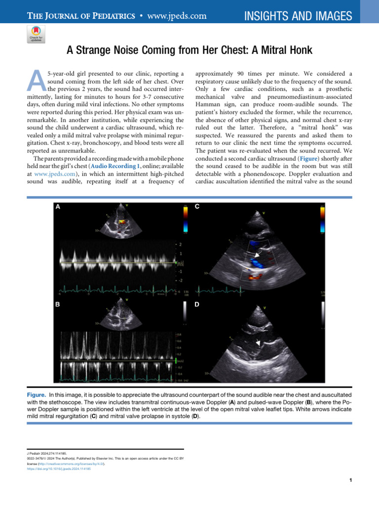 A Strange Noise Coming From Her Chest A Mitral Ho | PDF | Heart ...