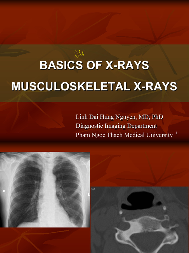 2024MSK BASIC XRAYS-DR LINH_240709_160307 | PDF | Bone | X Ray