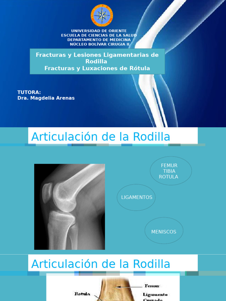 Fracturas y Lesiones de Rodilla | PDF | Rodilla | Articulaciones
