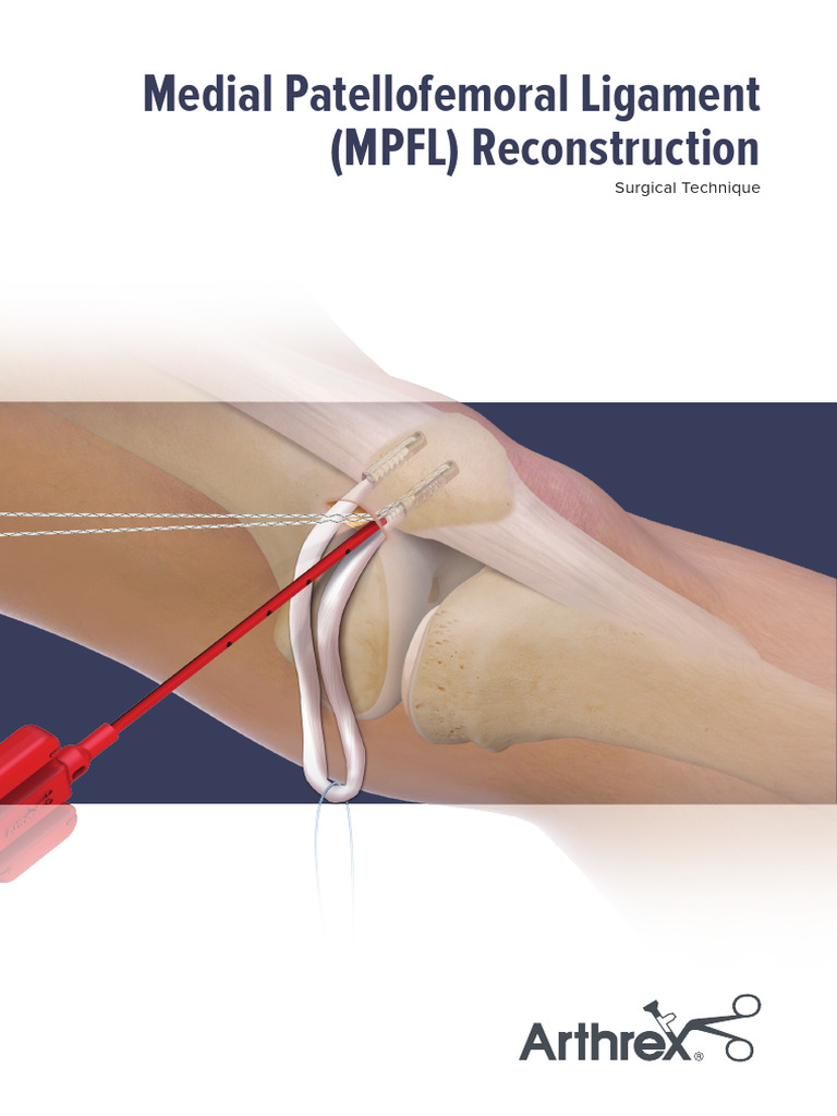 Medial Patellofemoral Ligament Mpfl Reconstruction | PDF | Knee ...