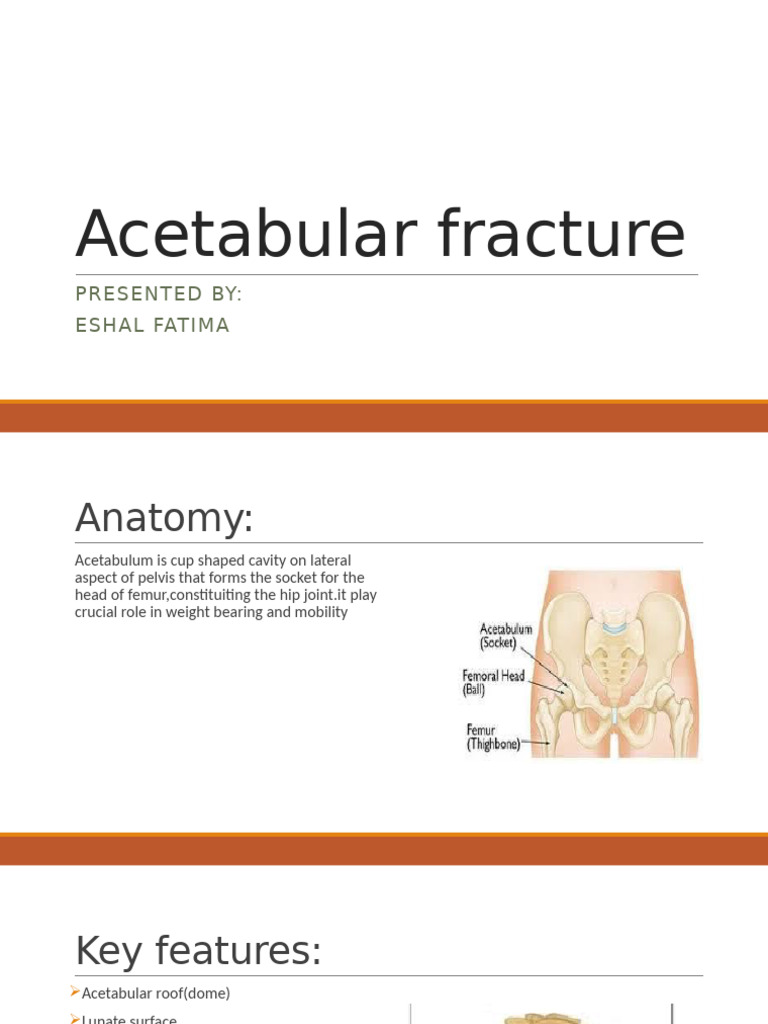 Acetabular fracture | PDF