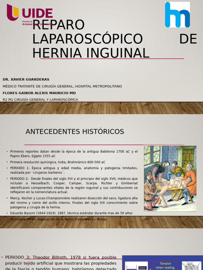 Hernioplastia Inguinal Laparoscópica Tapp Vs Tep 1 | PDF | Cirugía