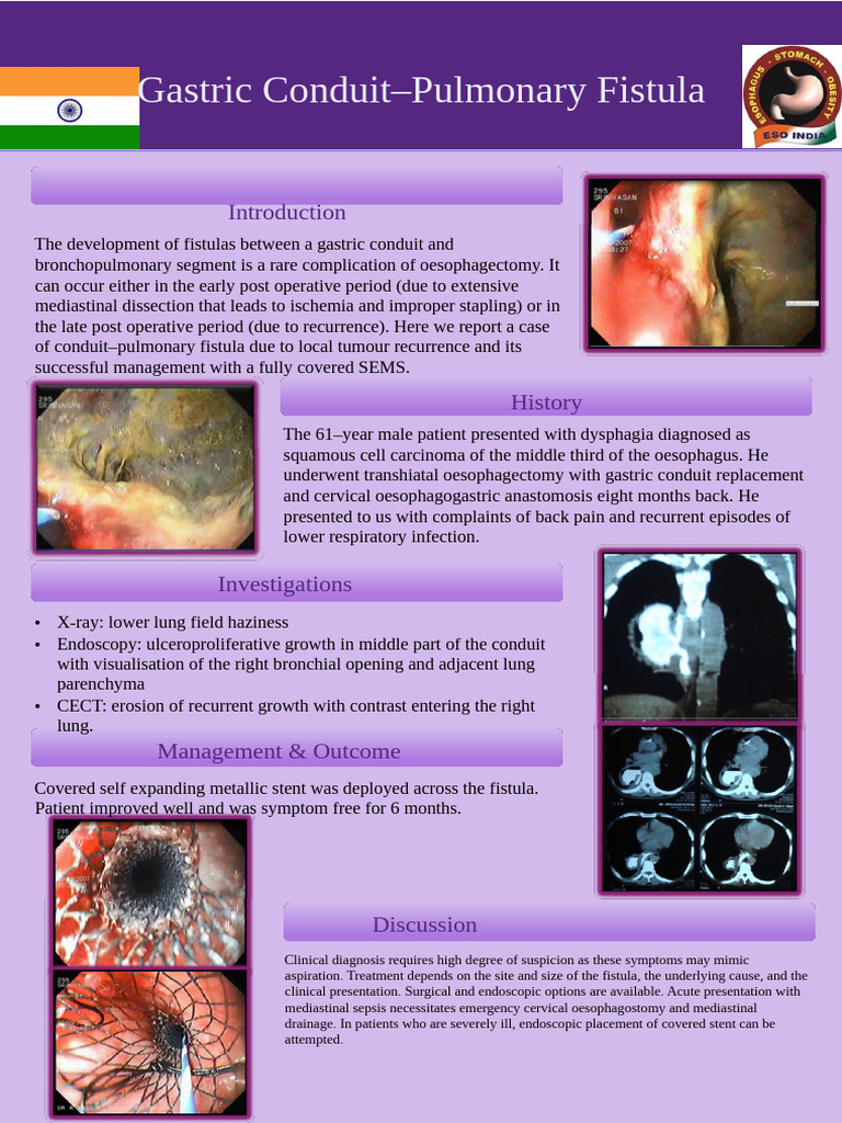 Conduit-Pulmonary Fistula | PDF
