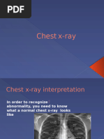 Costophrenic Angle Blunting Causes | PDF | Radiology | Lung