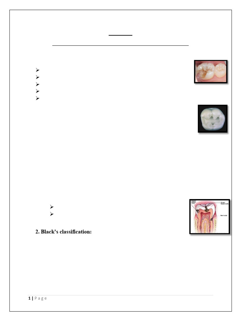 Cavity Classifications in Dentistry | PDF | Tooth Enamel | Tooth