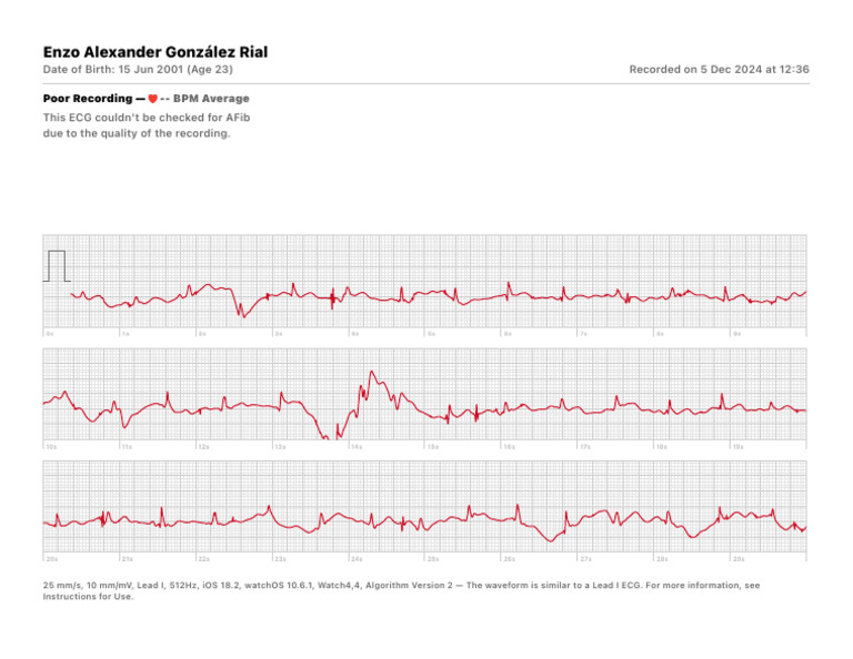 Health - Enzo Alexander González Rial - ECG 2024-12-05 at 12.36 | PDF