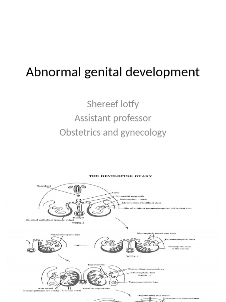 Abnormal genital development | PDF