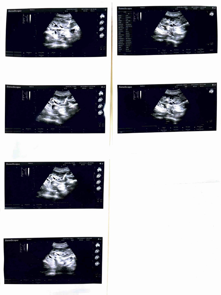 Renal Biopsy Imaging | PDF