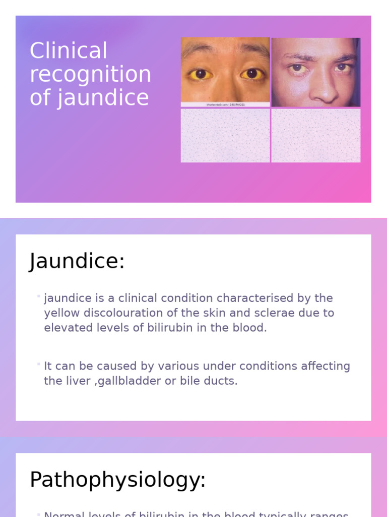 Clinical Recognition of Jaundice | PDF
