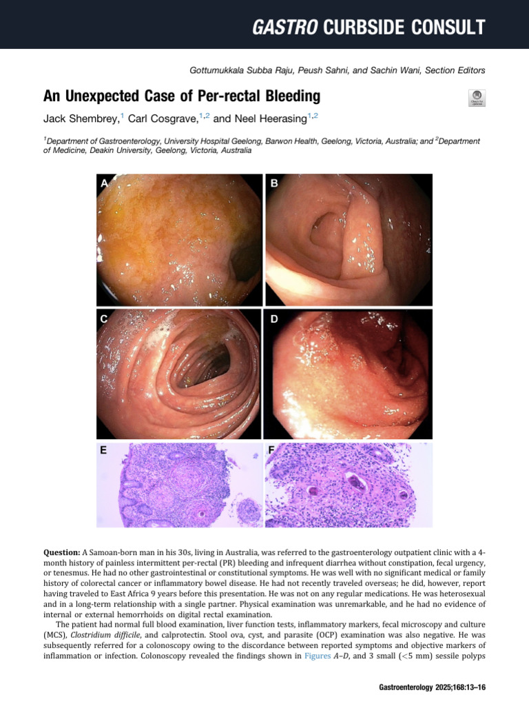 PIIS0016508524052223 | PDF | Colonoscopy | Constipation