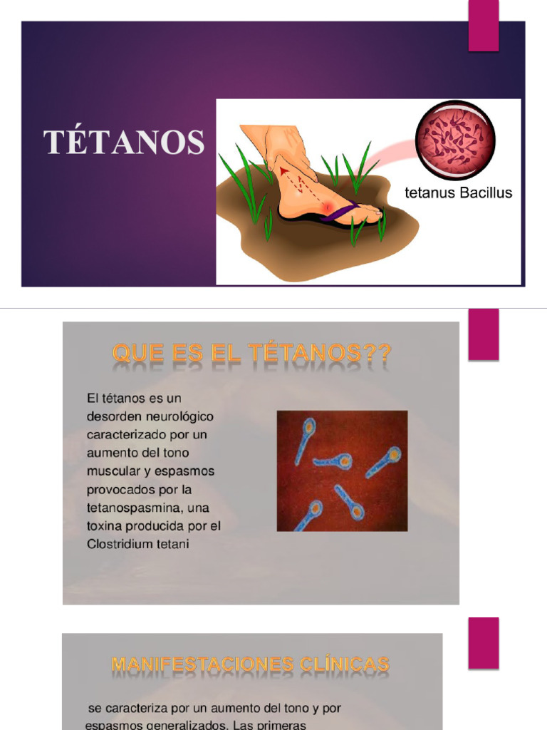 Síntomas y Complicaciones del Tétanos | PDF | Medicina | Especialidades ...