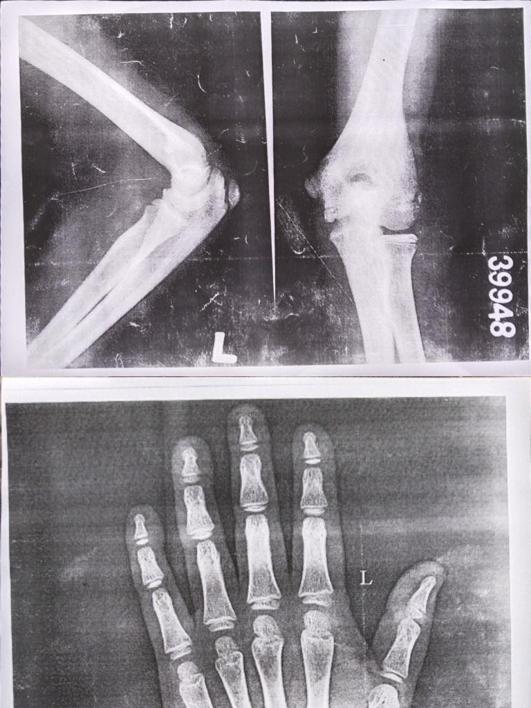 Ospe and Mojar And. Minor Exercise FM | PDF