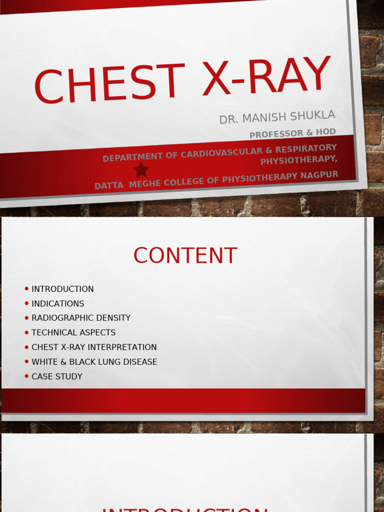 Chest X-Ray Guide for Physio Students | PDF