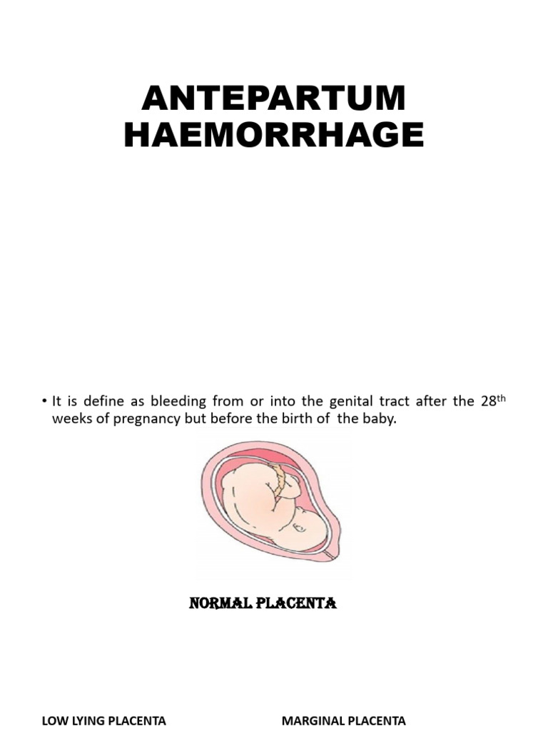 Antepartum Haemorrhage | PDF