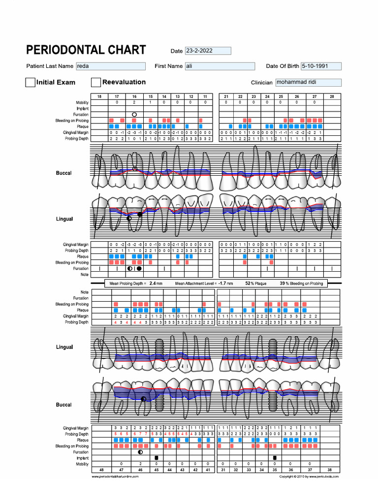 Periodontal Chart Online - Www.perio-Tools.com22222222 | PDF