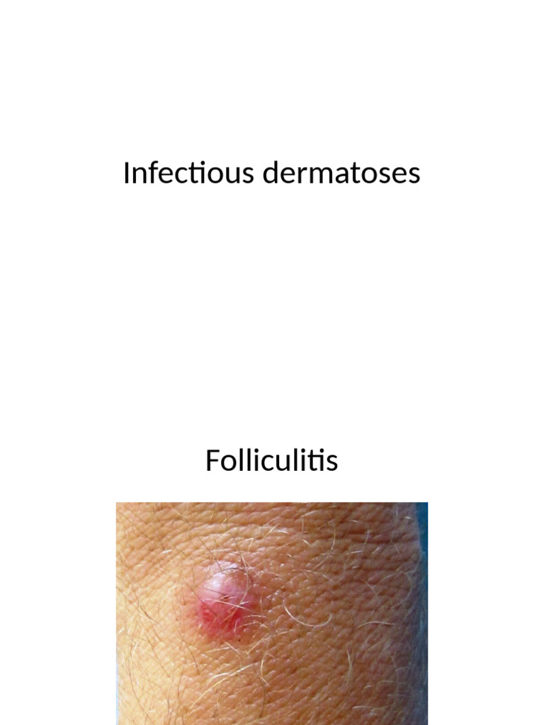Overview of Infectious Dermatoses | PDF