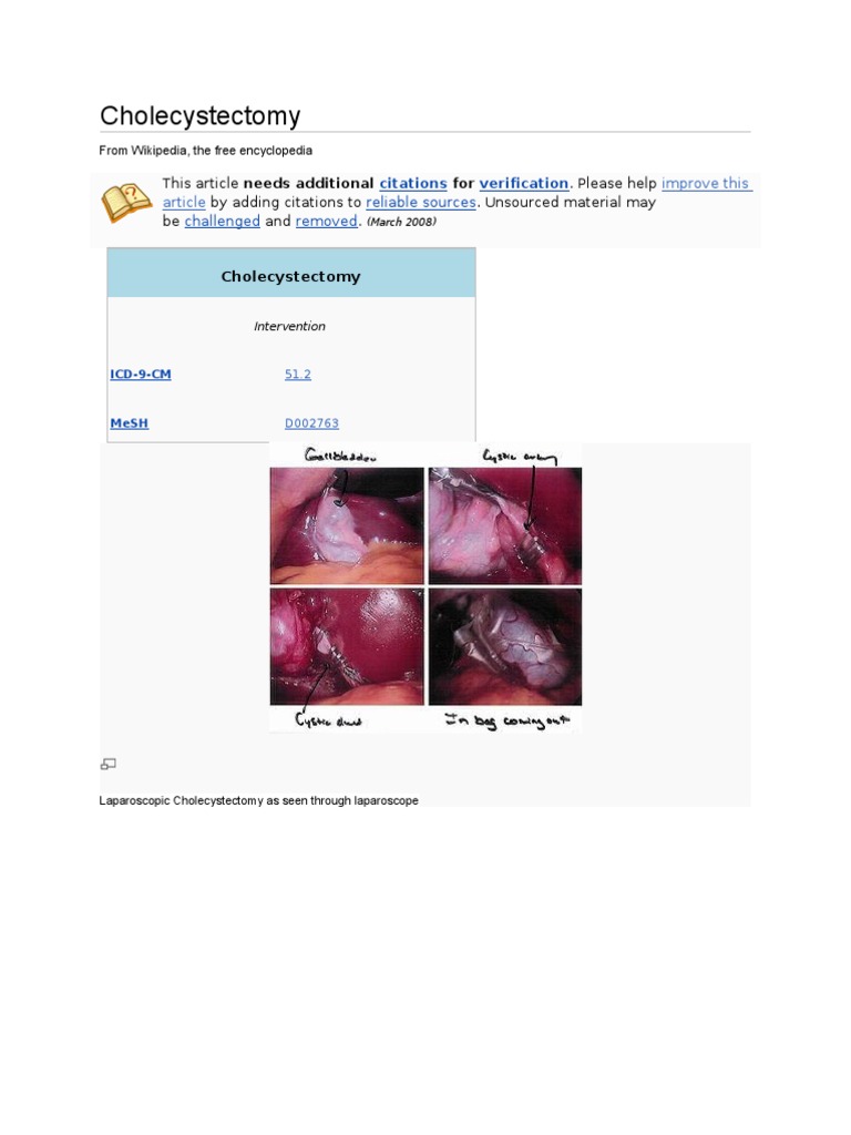 Chole | PDF | Clinical Medicine | Health Sciences