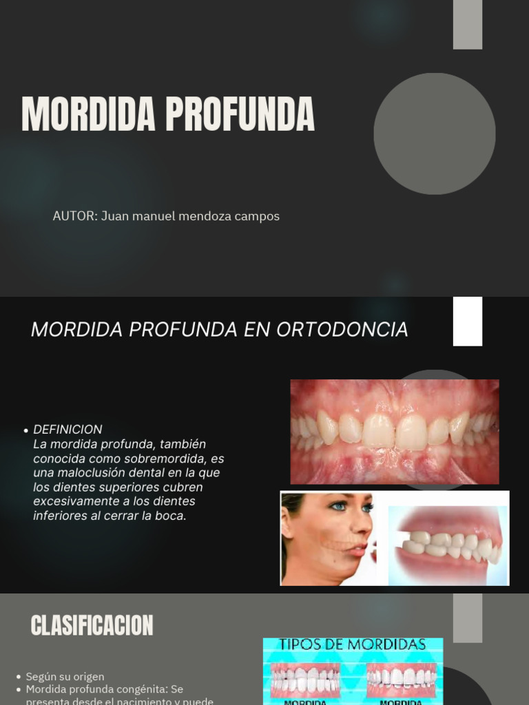 Mordida Profunda: Causas y Tratamiento | PDF