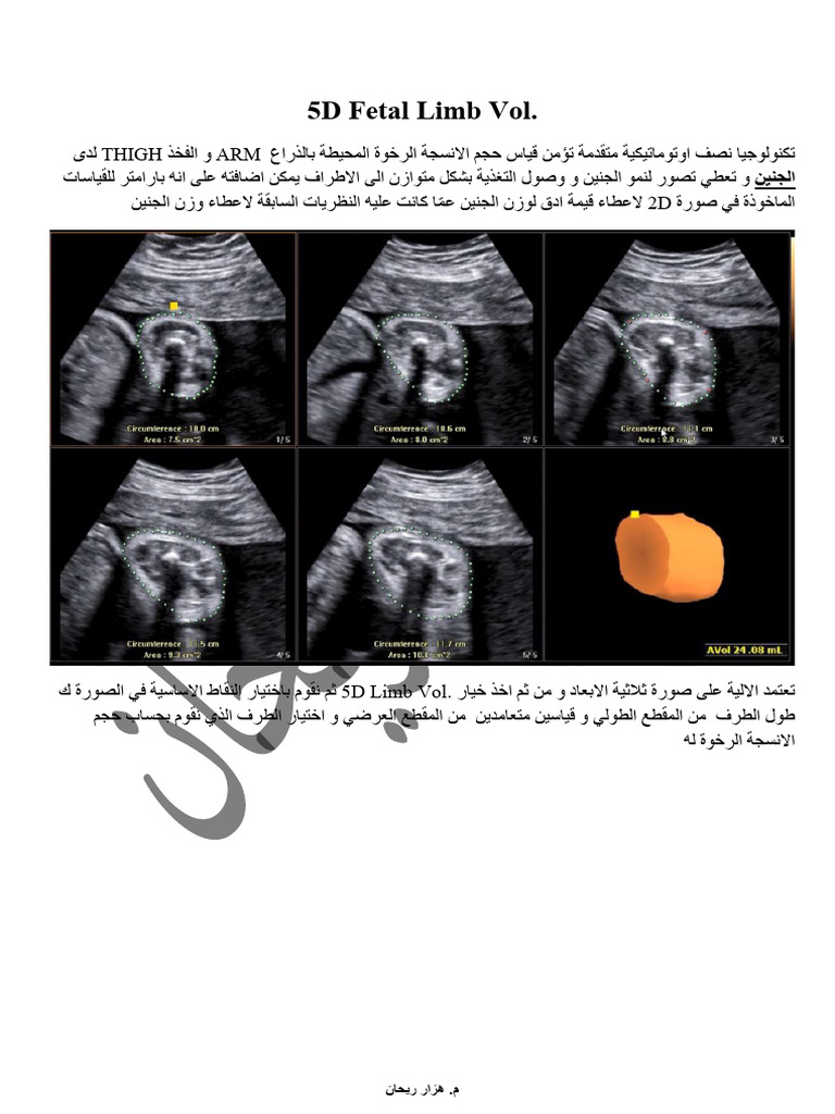 5d Limb | PDF