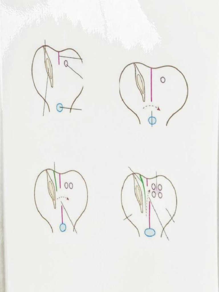 Embryology Ospe, Charts | PDF