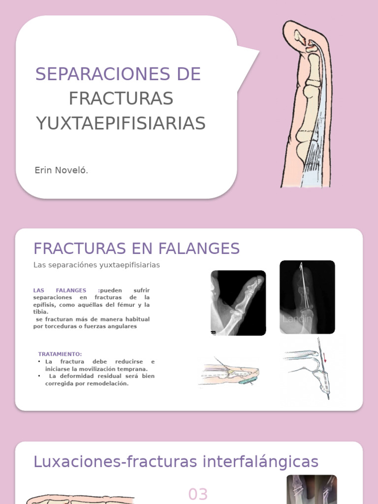 Separaciones de Fracturas Yuxtaepifisiarias | PDF | Sistema ...