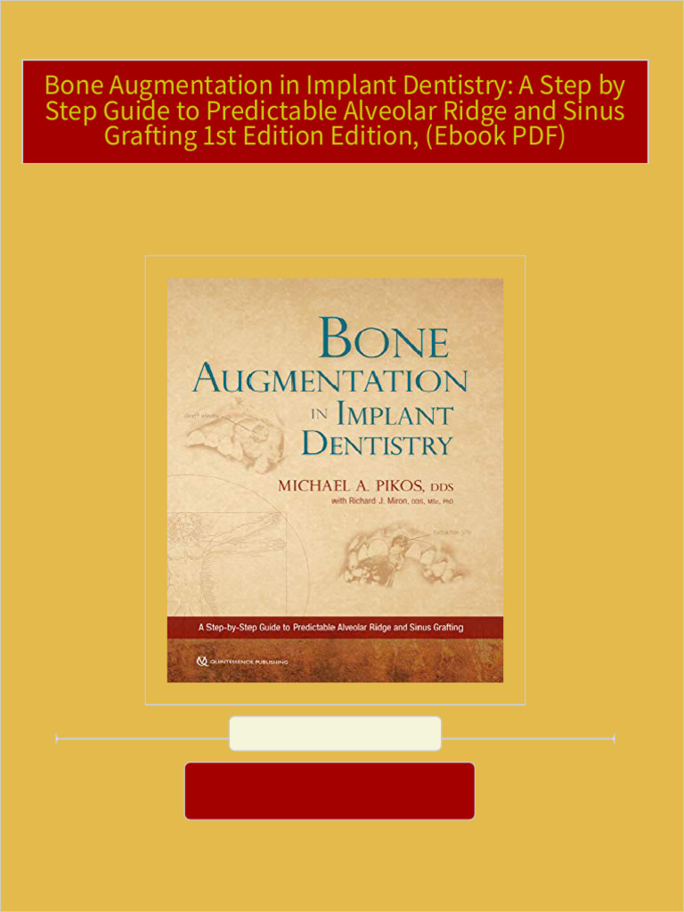 Complete Download Bone Augmentation in Implant Dentistry: A Step by ... Complete Download Bone Augmentation in Implant Dentistry: A Step by ...