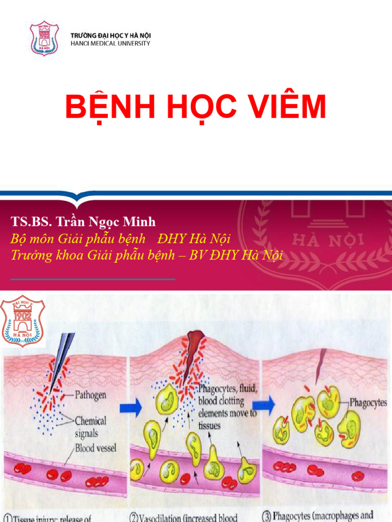 S1.3 - LEC7 - Viêm | PDF