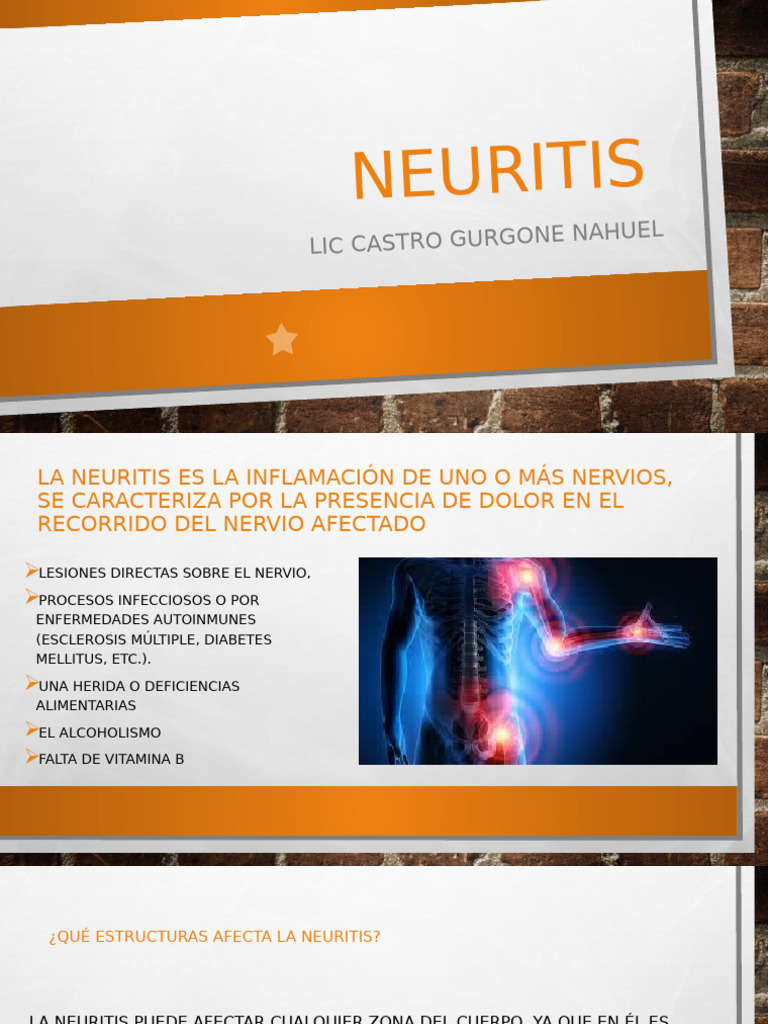 Neuritis | PDF | Mano | Anatomía del miembro inferior