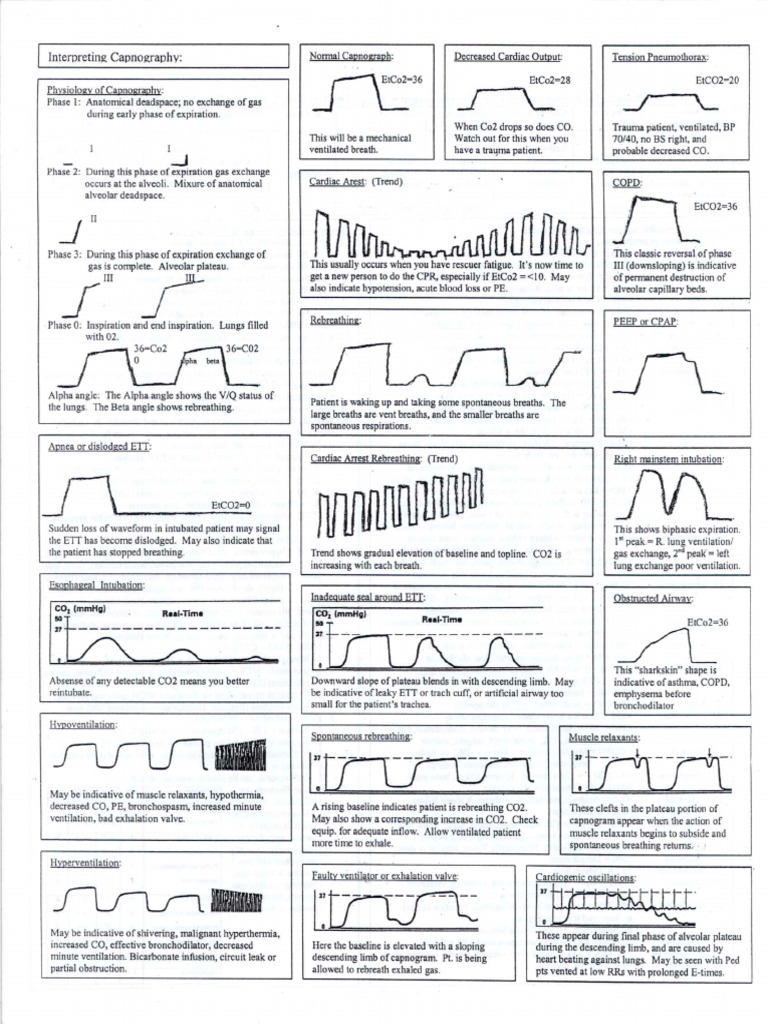 Capnography Cheat Sheet | PDF