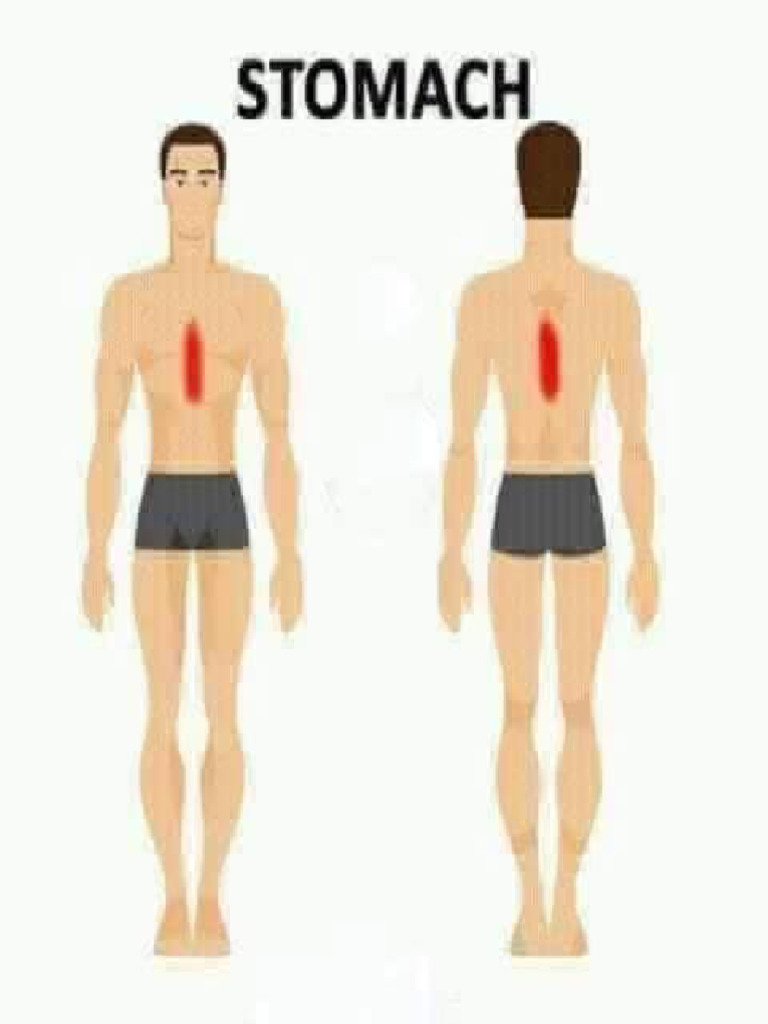 Referred Pain | PDF