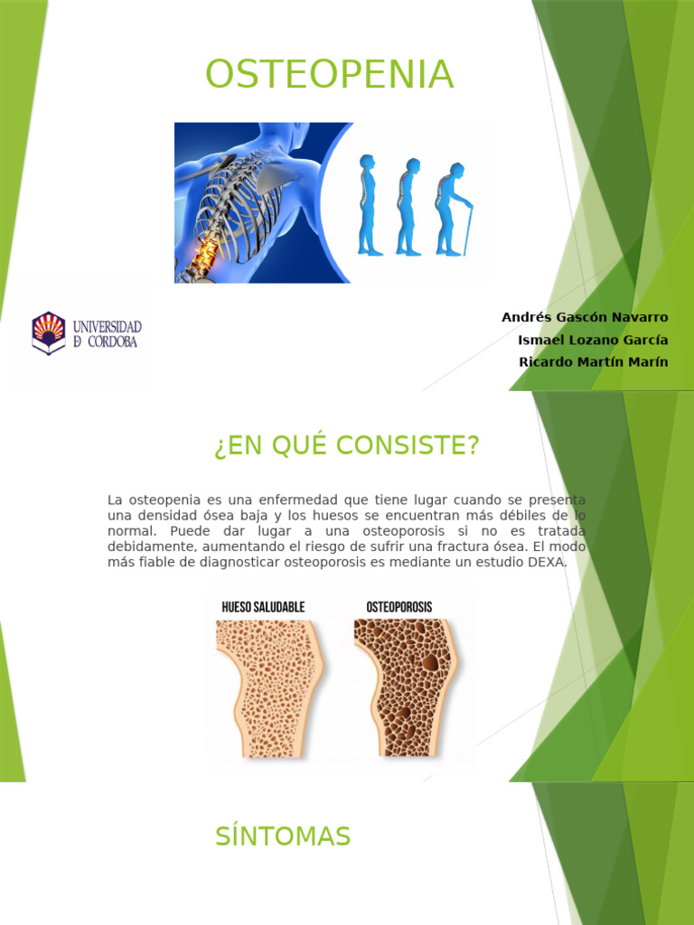 Osteopenia: Síntomas, Prevención y Tratamiento | PDF