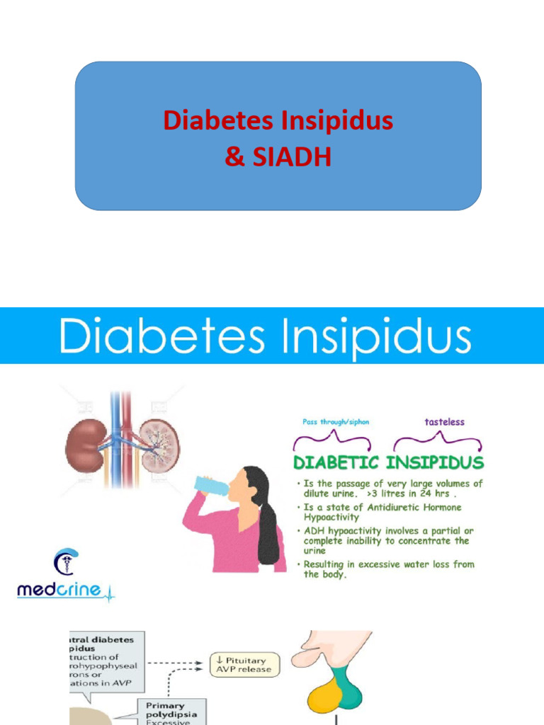 DI & SIADH.pptx | PDF | Clinical Medicine | Medical Specialties