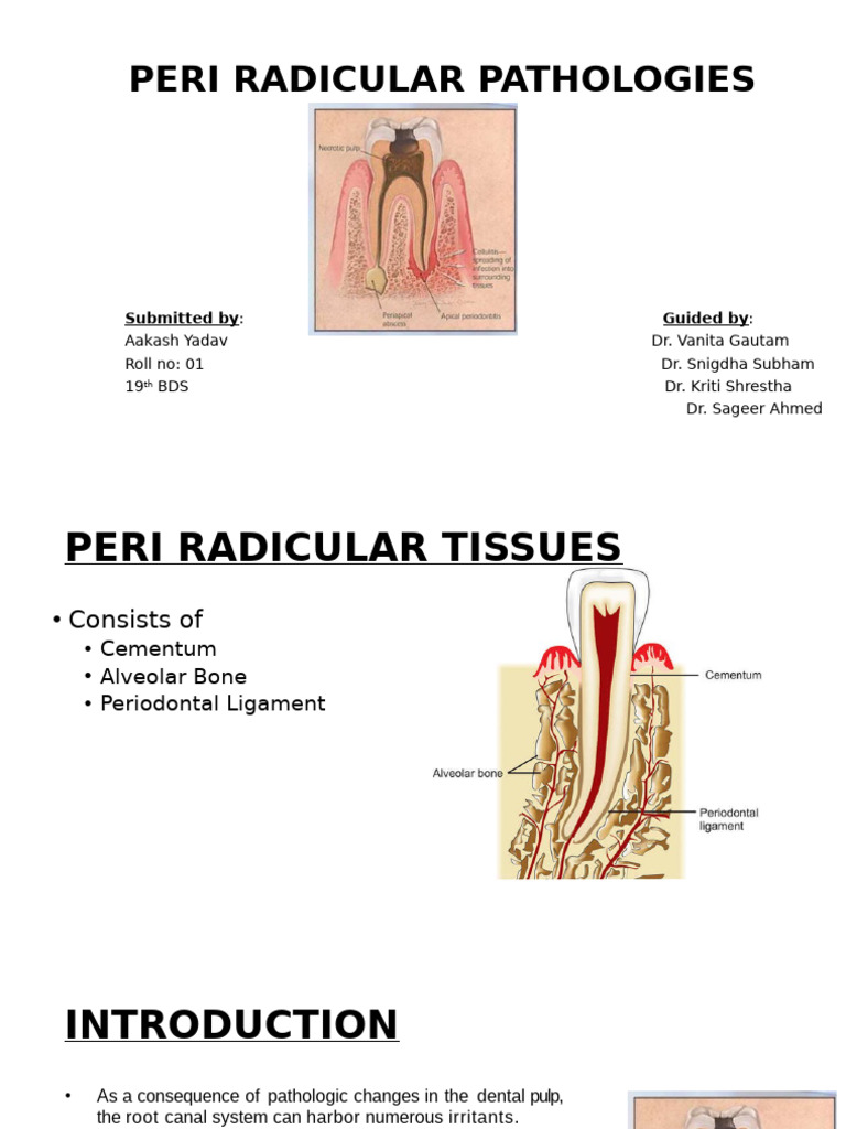 01. Aakash Yadv Peri Radicular Pathologies | PDF | Human Tooth ...
