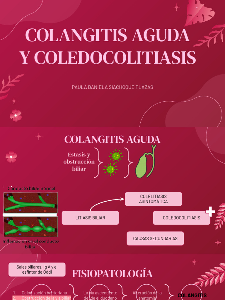 Colangitis Aguda y Coledocolitiasis | PDF | Abdomen | Sistema exocrino