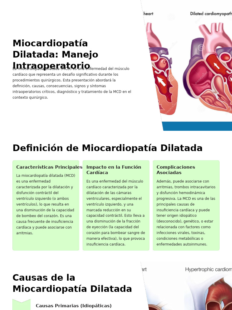 Miocardiopatia Dilatada Manejo Intraoperatorio | PDF | Corazón | Insuficiencia cardíaca