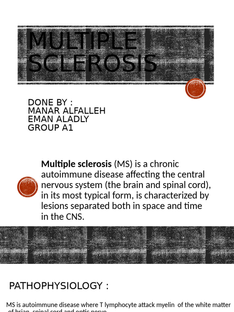 ms-1 | PDF | Multiple Sclerosis | Clinical Medicine